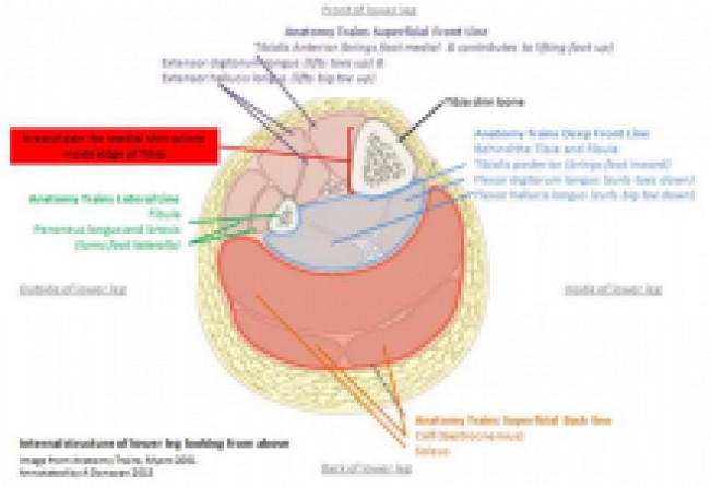 Do you suffer from shin splints? (Donovan 2013) - Alternative ...